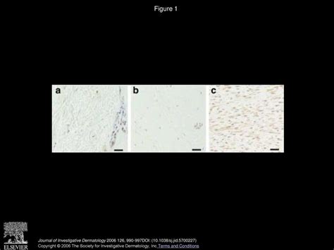 Decreased Prostaglandin E2 Production By Inflammatory Cytokine And