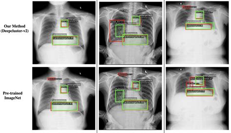 Qualitative Results On Detecting Abnormal Nodules In The Vindr Cxr