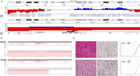 Mtap Homozygous Deletion In Myxofibrosarcoma A Referring To Download Scientific Diagram