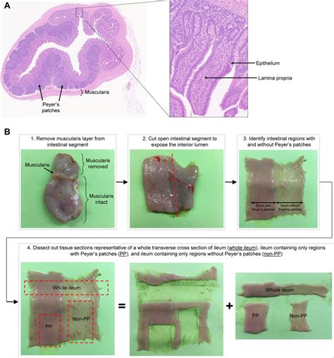 Histology Of Ileum Peyers Patches