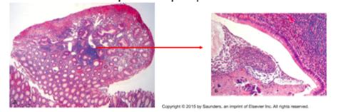 Ders Path Exam Flashcards Quizlet