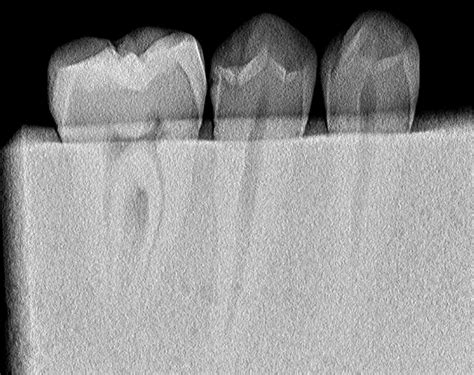 Image Enhanced By Emboss Filter Download Scientific Diagram