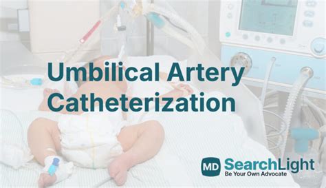 Umbilical Artery Catheterization Umbilical Catheterization Md Searchlight