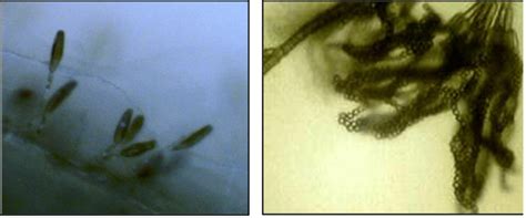 Microscopic Fungi Bipolaris Sorokiniana Left And Penicillium Sp On Download Scientific
