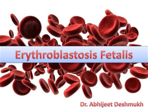 Erythroblastosis Fetalis PPTX