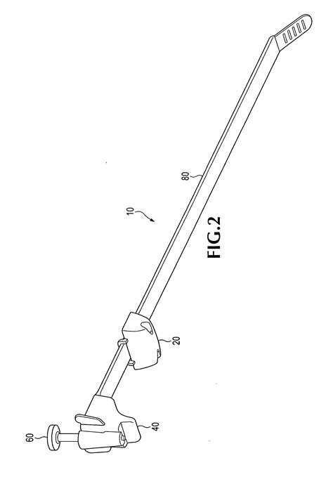 Vascular Compression Patented Technology Retrieval Search Results Eureka Patsnap