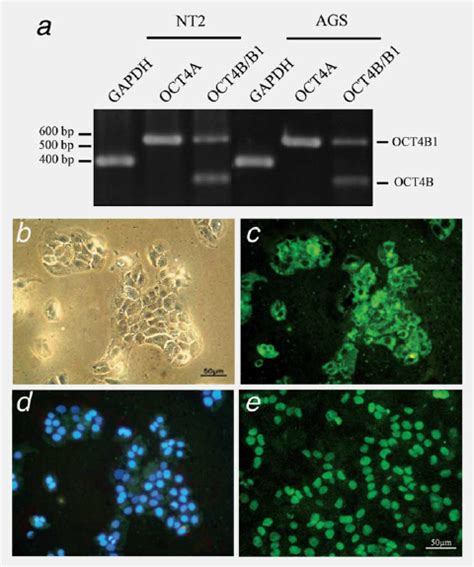 expression of oct4 variants in nt2 and ags cell lines a rt pcr