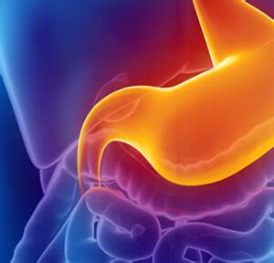 Laparoscopic Transgastric Resection Of Gastrointestinal Stromal Tumor And Simultaneous Sleeve
