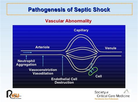 Sepsis And Septic Shock
