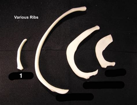 Various Ribs And The Sternal Region Flashcards Quizlet