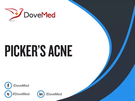 Pickers Acne Dovemed