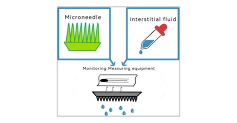 Meng Wu On Linkedin A Review Of Recent Advances In Microneedle Based Sensing Within The Dermal…