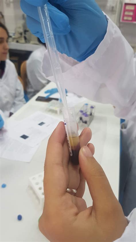 Hematología Práctica 5 Obtención De Plasma Rico En Plaquetas