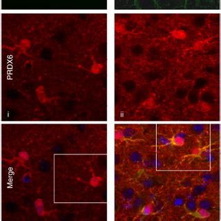 Representative D Gel Image Of Mouse Brain Cortex Homogenate Labeled Download Scientific