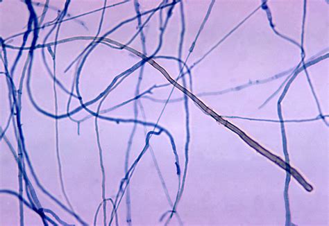 Conidiophore Conidiophore