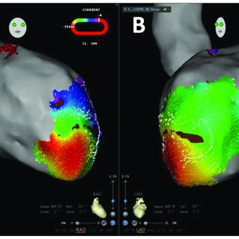 Representative Image Of Velocity Vector Based Coherent Mapping For Download Scientific Diagram
