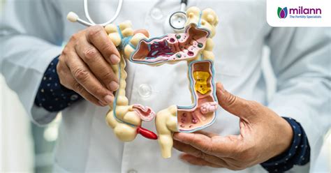 Milann The Fertility Specialist