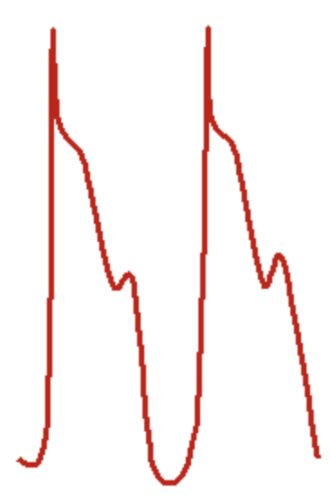 Invasive Monitoring Flashcards Quizlet