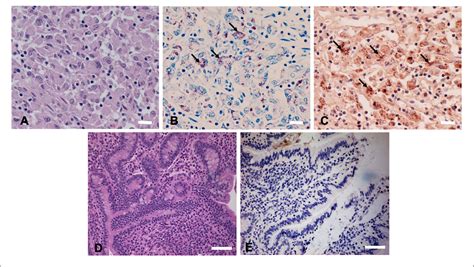 Figure 2 From Detection Of Mycobacterium Avium Subspecies Paratuberculosis Map Microorganisms