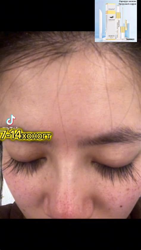 Үс уналтыг зогсоож ургалт түргэсгэх серум 💎Үс унах халзрах бууралтах салаалах Үсний угийг