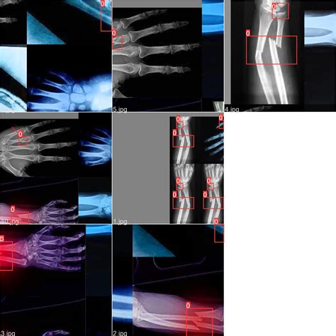 Github Ertugrul Object Detection Yolov Yolov Ile K R K Kemik Tespiti