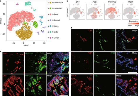 Luminal C Cells In The Normal Human Prostate A Visualization Of The Download Scientific