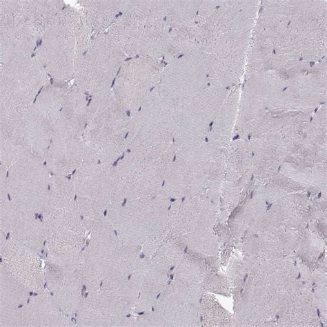 Rabbit Polyclonal Anti Klf17 Antibody Buy For Research Highly