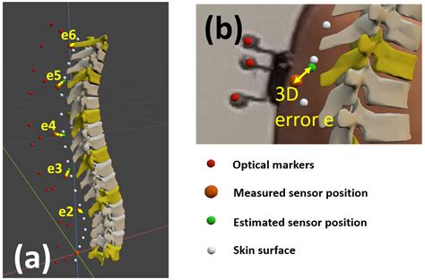 determination of the 3d human spine posture from wearable inertial sensors and a multibody model