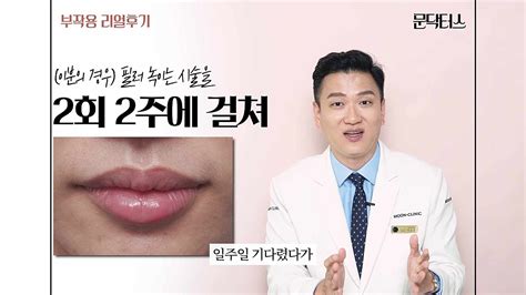 문클리닉 입술필러 시술 시 생길 수 있는 부작용 네이버 Tv