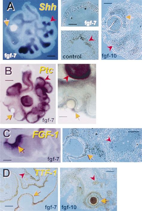 Gene Expression Analysis In Lung Organ Cultures Grafted With Fgf 7 And Download Scientific