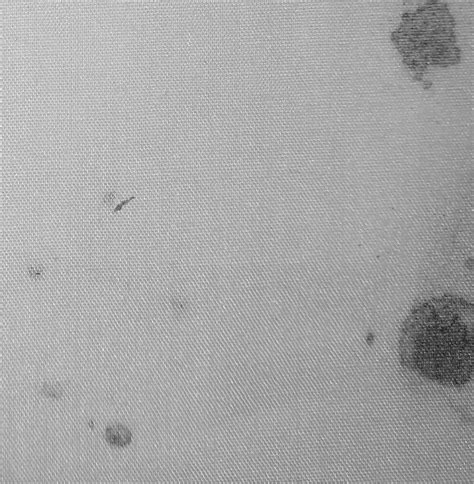 Defectpixel Object Detection Dataset And Pre Trained Model By Dataaug