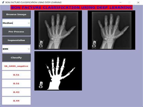 Knn Classifier As Show In Figure When Svm Classifier Is Applied The