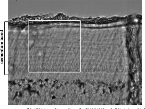 Figure From Hidden Markov Random Field And Frame Modelling For TCA Image Analysis Semantic