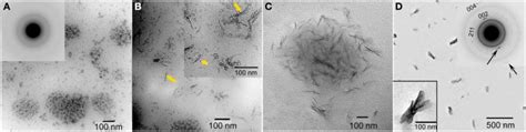 Tem Micrographs Of Calcium Phosphate Mineral Products Formed In The
