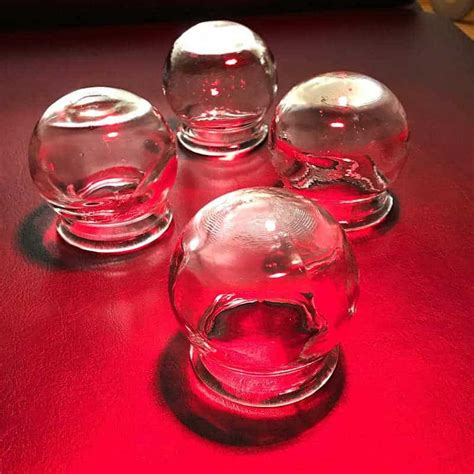 Chinese Cupping History At Zane Humphrey Blog