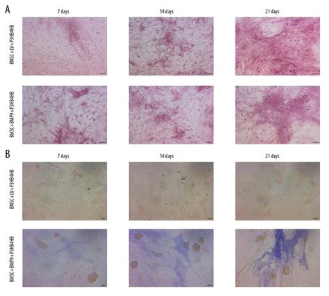 A Composite Tissue Engineered Bone Material Consisting Of Bone