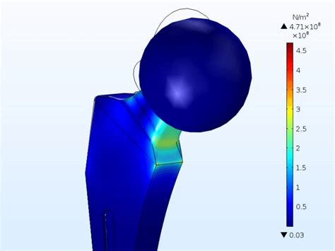 Finite Element Analysis Results Of Proposed Hip Implant Model Showing Download Scientific