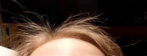 Spliss Verstecken Kaputte Haare