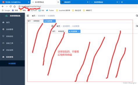 【若依vue前后端分离版框架 初探】尚医疗项目10尚医疗开源 Csdn博客