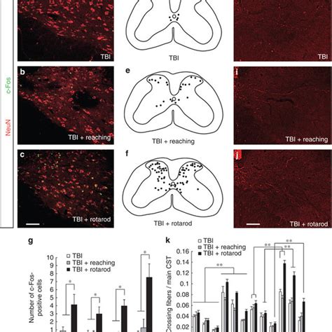 Tbi Mouse Model A Unilateral Sensorimotor Cortex Contusion By Tbi