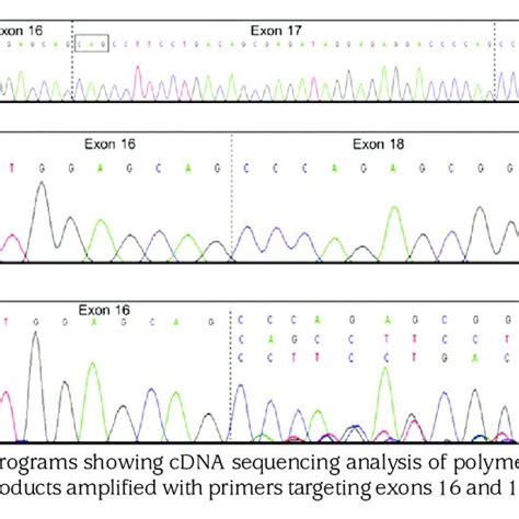 The Reference Genomic Dna Sequence Is Provided A Dashed Line Denotes