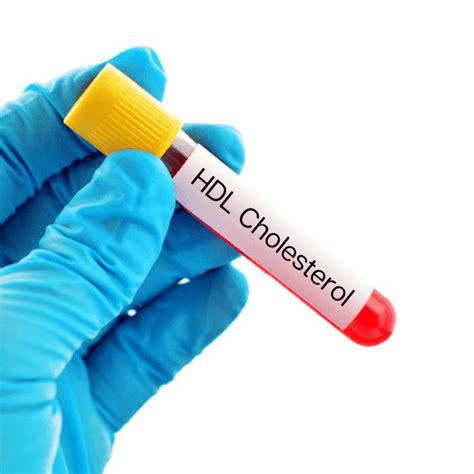 HDL Cholesterol Test Kit LDL Blood Sampling For Home 29