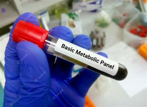 Urea And Electrolytes Au Script