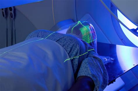 Radiotherapy For Head And Neck Cancer Types Success Rate Side