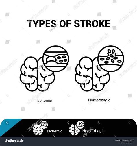 Brain Stroke Icon Ischemic Hemorrhagic Icon Stock Vector Royalty Free