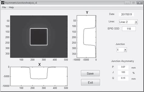 Gui For Asymmetric Jaw Alignment Displaying The Summed Assymetric Jaw Download Scientific