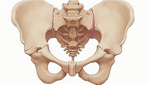 Pelvic Fracture Md Searchlight