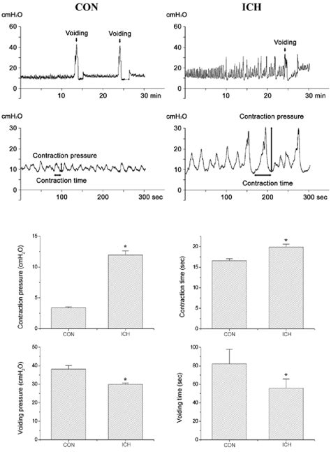 Effect Of Induction Of Ich On Urodynamic Parameters A Cystometry Download Scientific Diagram