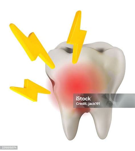 치아 구멍 치통 치과 치료 통증 메쉬 그라디언트 Wes의 개념의 3d 벡터 일러스트 레이 션 개념에 대한 스톡 벡터 아트 및 기타 이미지 Istock