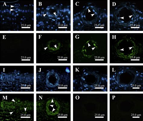 Detection Of In Situ Dna Fragmentation By Dapi And Tunel Assay A D